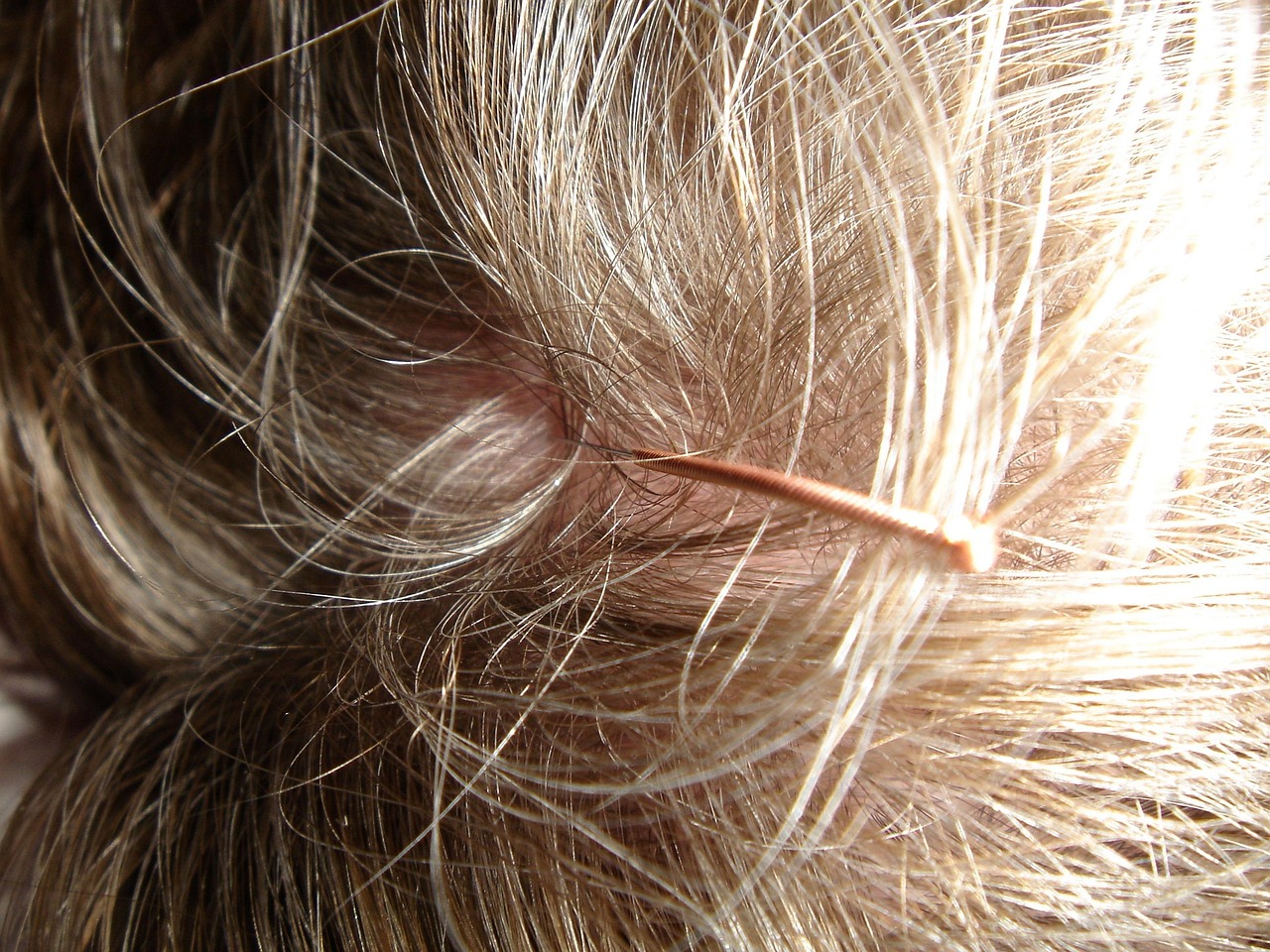 Acupuncture Needle - Free photo on Pixabay