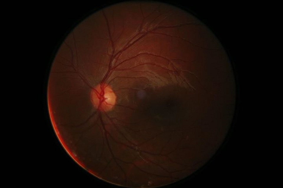 Digital Retinal Photography - Free photo on Pixabay