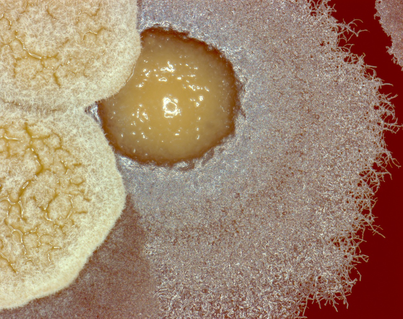 Nocardia Farcinica Bacteria - Free photo on Pixabay