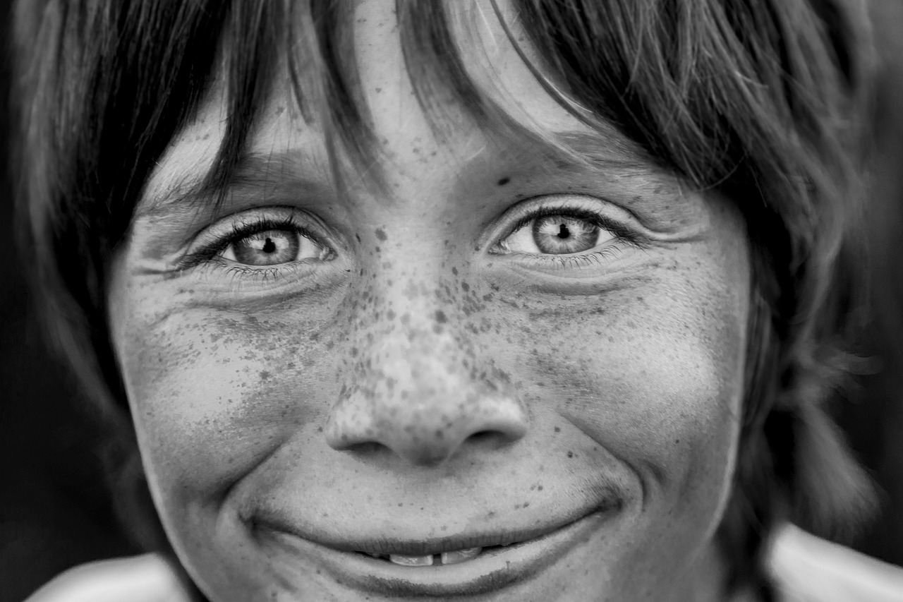 70,000+ Free Freckle Face & Freckles Images - Pixabay