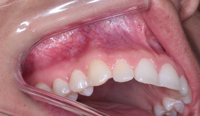 Embouchure Dentiste - Photo gratuite sur Pixabay - Pixabay