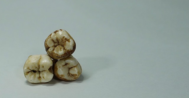 Zahn Molar Anatomie - Kostenloses Foto auf Pixabay - Pixabay