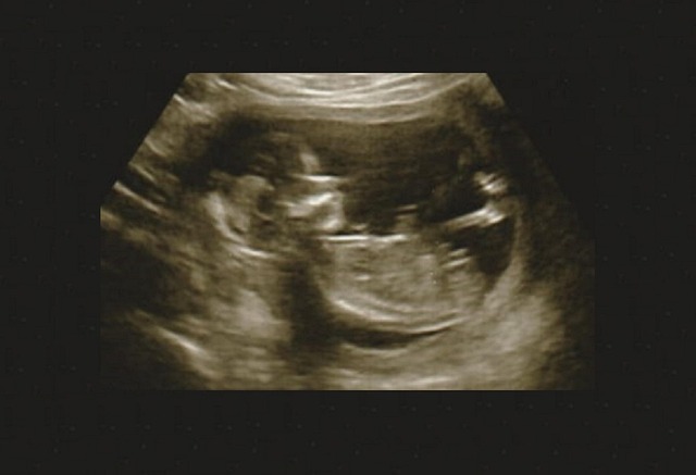 Baby Scan Photo Male - Free photo on Pixabay - Pixabay