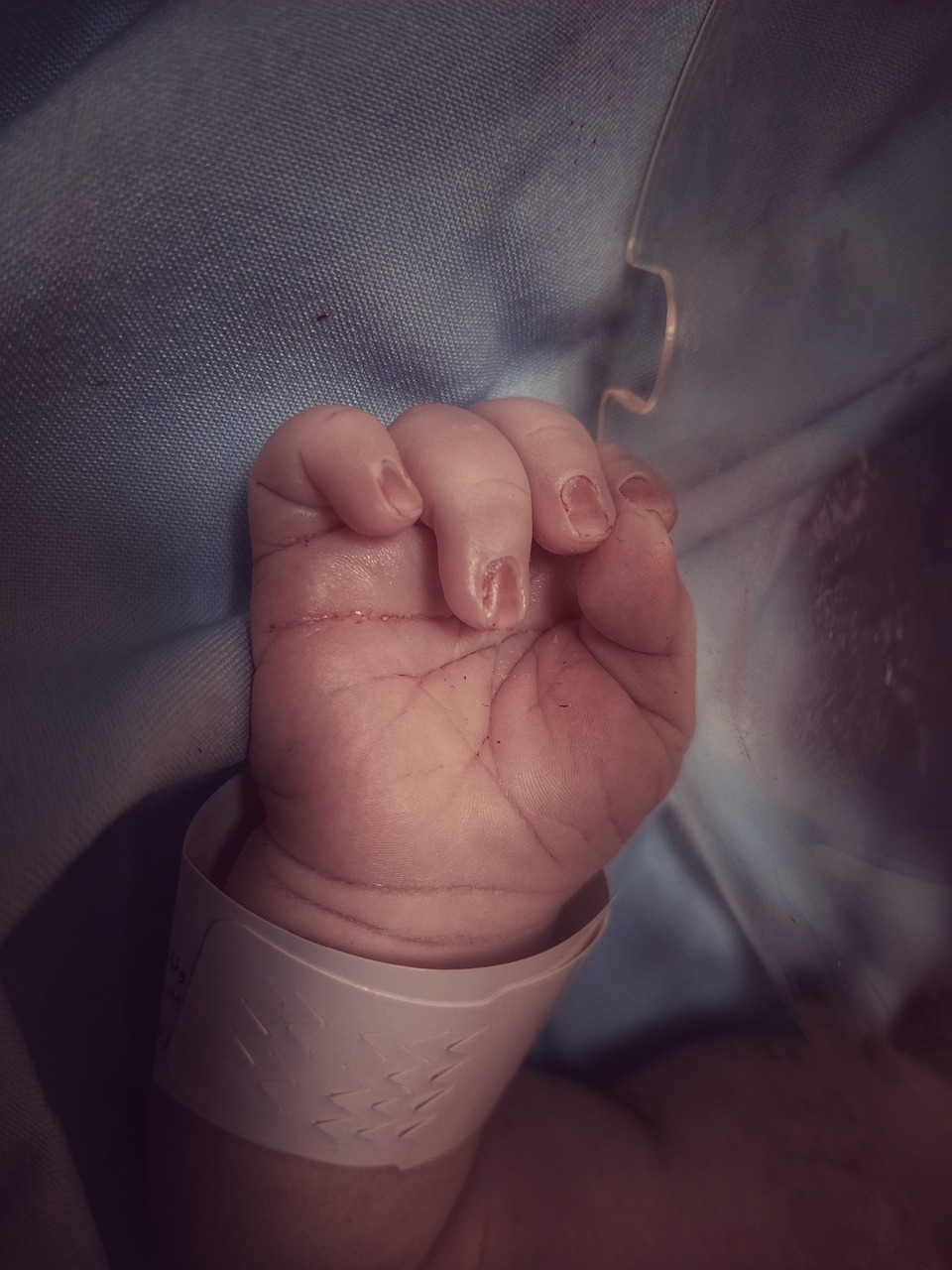 Sleeping Babe Illness Free Photo On Pixabay Pixabay