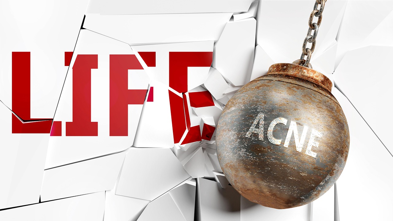 Peste 60 de imagini gratuite cu Acne Ekstruder și Acnee - Pixabay