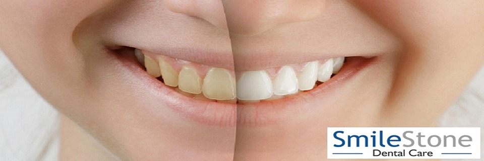 Best Dentist In Nagpur Dental - Free photo on Pixabay - Pixabay