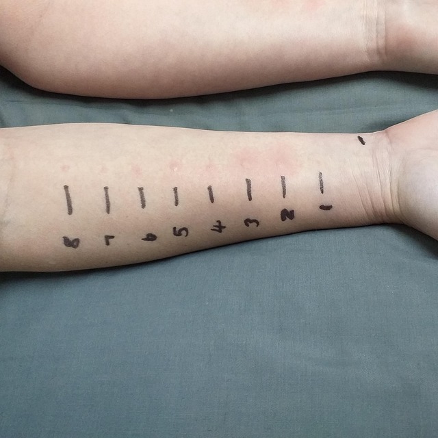 Allergy Test Pin - Free photo on Pixabay - Pixabay