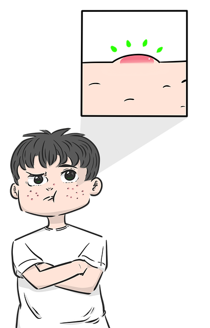 Download Man, Acne, Skin. Royalty-Free Stock Illustration Image - Pixabay