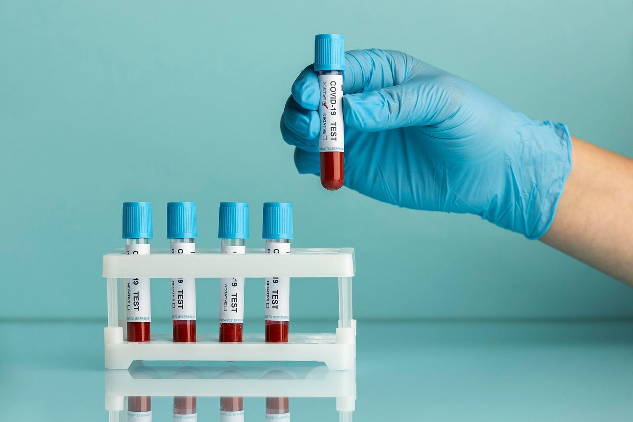 Covid Test Blood Lab - Free photo on Pixabay - Pixabay