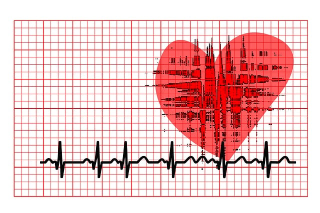 Download Arrhythmia, Palpitations, Heartbeat. Royalty-Free Stock ...