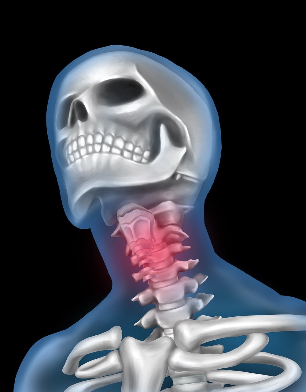 2,000+ Free Pain & Back Pain Images - Pixabay